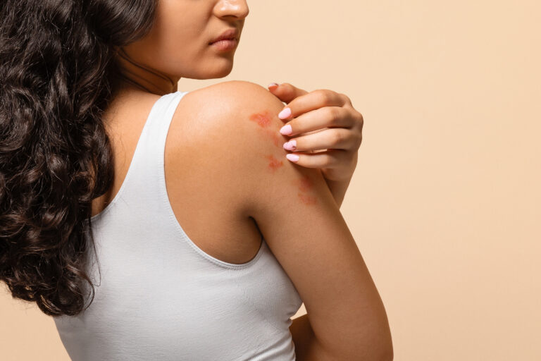 Common Inflammatory & Autoimmune Skin Conditions: Causes, Symptoms ...
